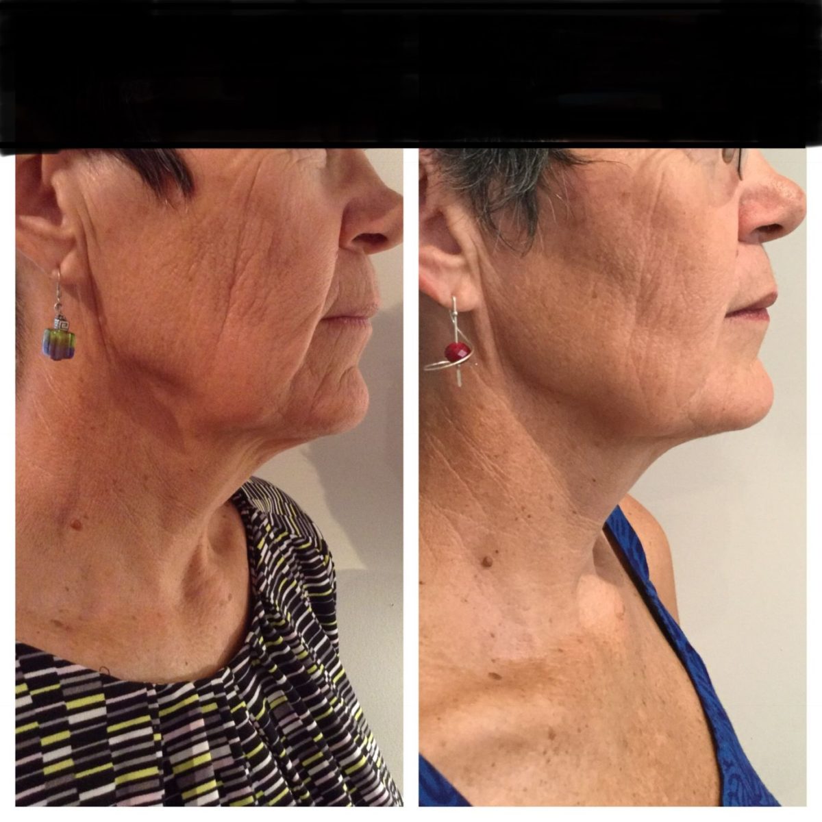Durango Medical Spa | Botox | Aesthetics and Wellness of Durango
